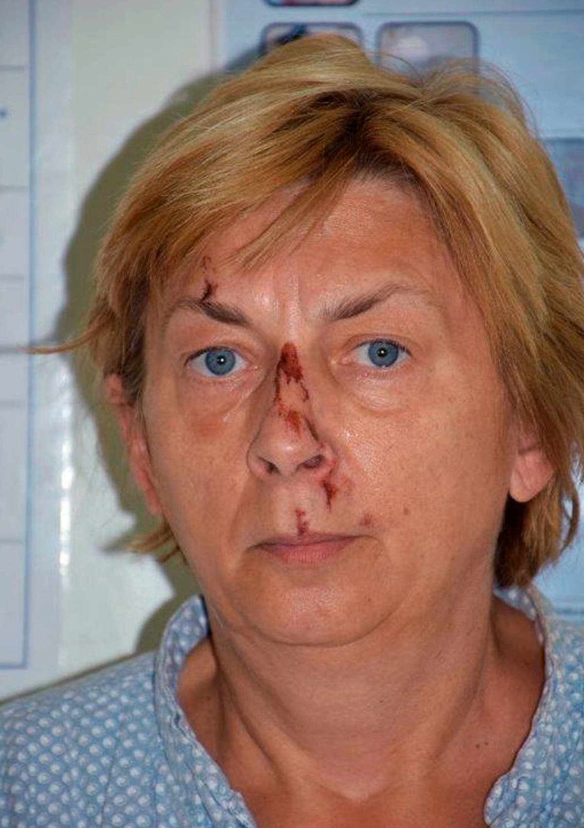 Policía croata busca ayudar a mujer que no recuerda quién es ...