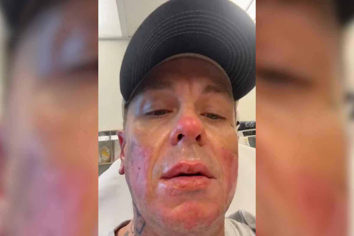 Sid Wilson, de Slipknot, dice que tiene la cara derretida tras la explosión de una fogata ...